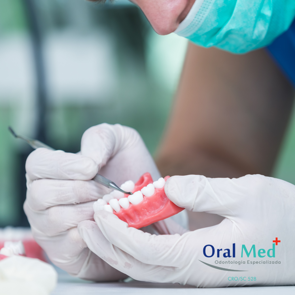 Prótese Protocolo - OralMed Odontologia Especializada